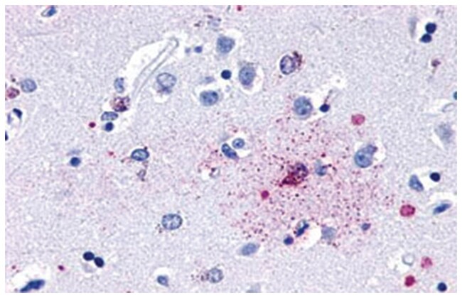 ANTI-GPR139 ANTIBODY 50UG