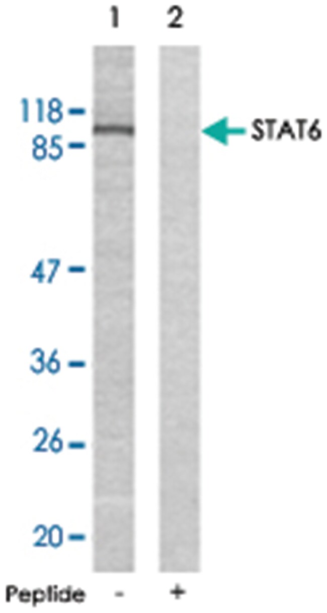 STAT6 Rabbit anti-Human, Polyclonal Antibody, Abnova 100μg; Unlabeled ...
