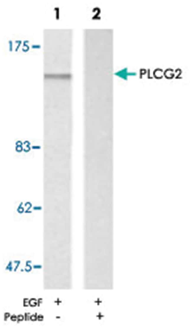 ANTI-PLCG2 ANTIBODY 100UG