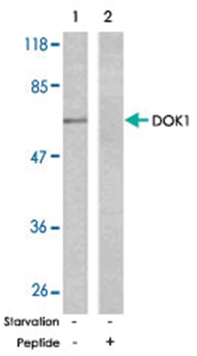 ANTI-DOK1 ANTIBODY 100UG