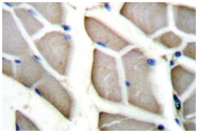 ANTI-ACTB ANTIBODY 100UL