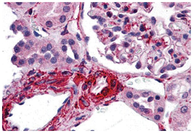 ANTI-CARD10 ANTIBODY 100UG