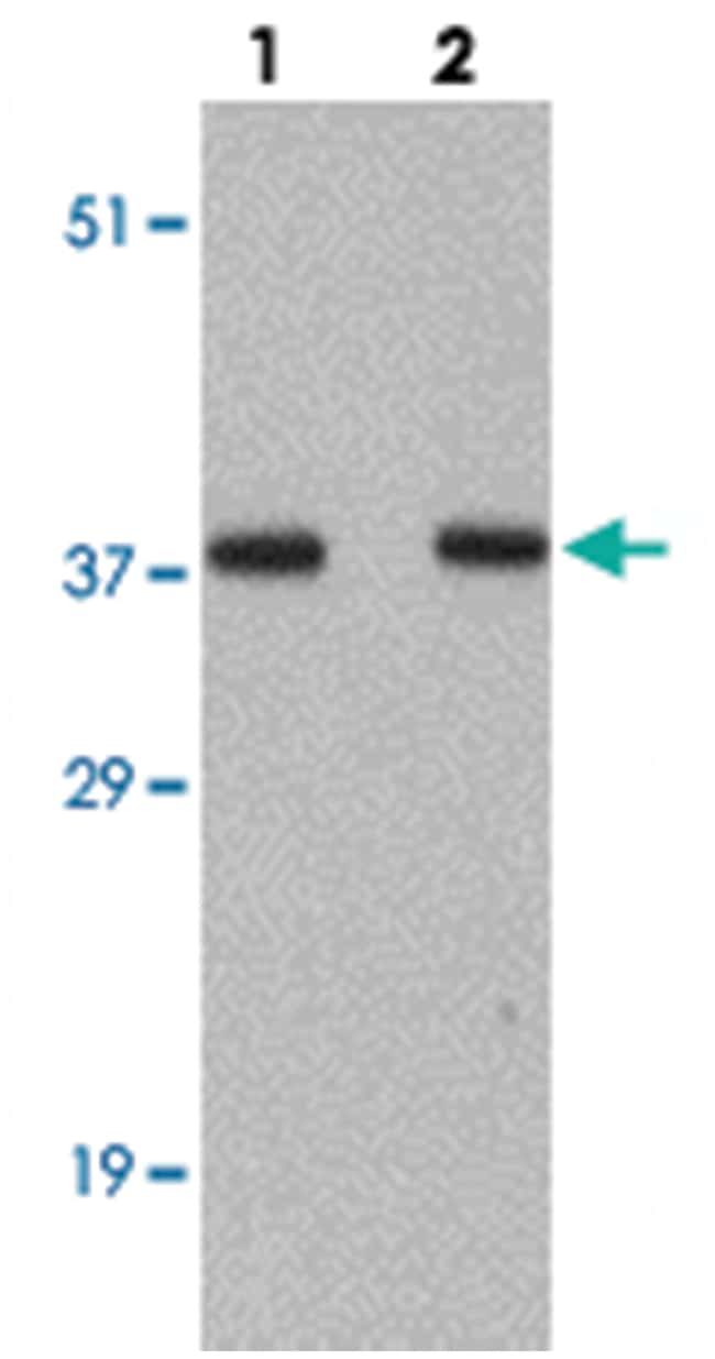 ANTI-SPP1 ANTIBODY 100UG