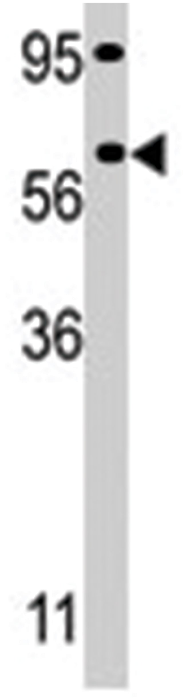 ANTI-RIOK1 ANTIBODY 400UL
