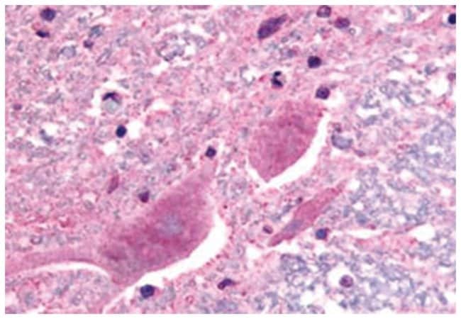 ANTI-SCN3A ANTIBODY 50UG