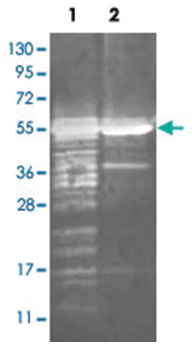ycjM (E. coli), Goat, Polyclonal Antibody, Abnova 100μg; Unlabeled ...