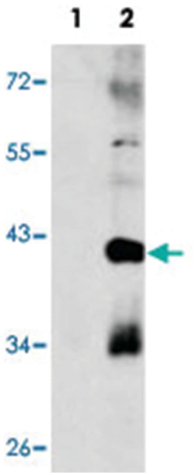 ANTI-MAPK11 ANTIBODY 400UL