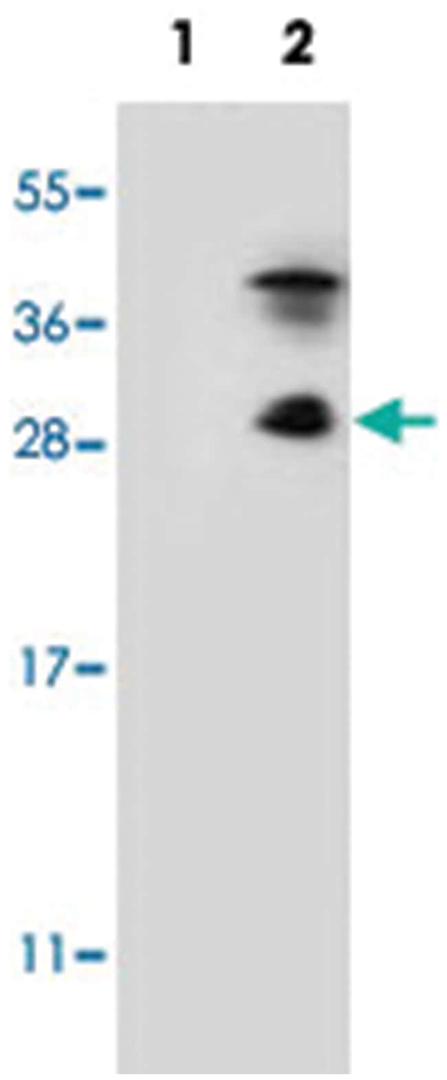 ANTI-KLK7 ANTIBODY 400UL