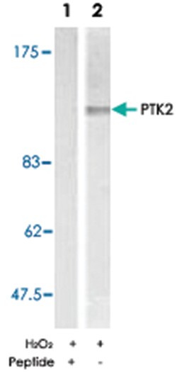 PTK2 Rabbit anti-Human, Rat, Polyclonal Antibody, Abnova 100μg ...