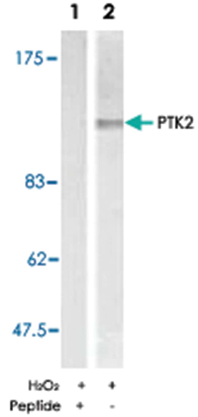 PTK2 Rabbit anti-Human, Rat, Polyclonal Antibody, Abnova 100μg ...