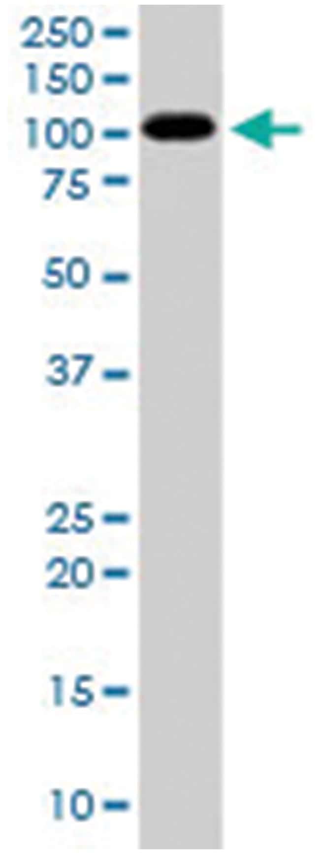 ANTI-AKAP8 ANTIBODY 100UG