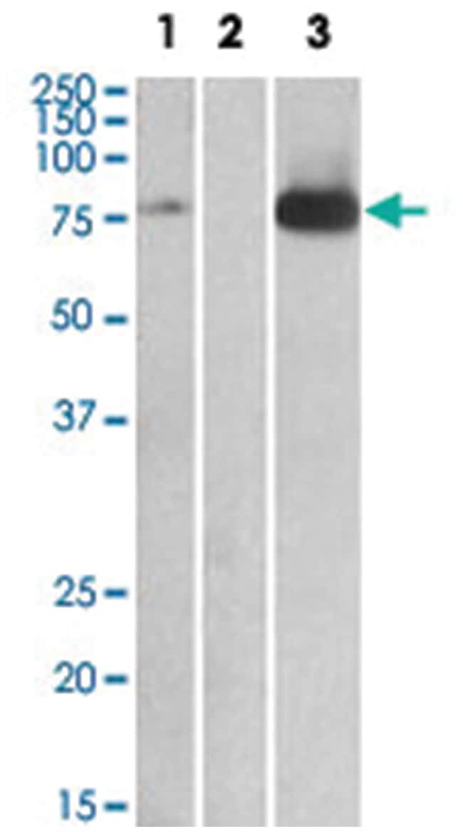 ANTI-MAP3K7 ANTIBODY 100UG