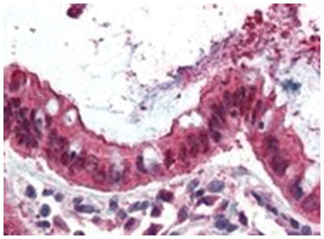 EZR, Goat, Polyclonal Antibody, Abnova 100μg; Unlabeled:Antibodies ...