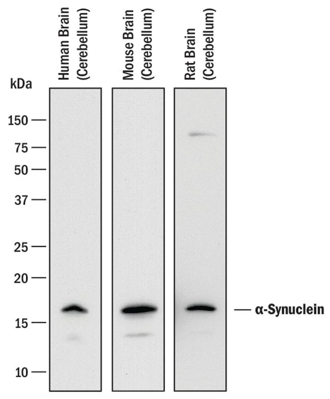 Human/Mouse/Rat alpha-Synuclein Antibody, R D Systems 100μg:Antibodies ...