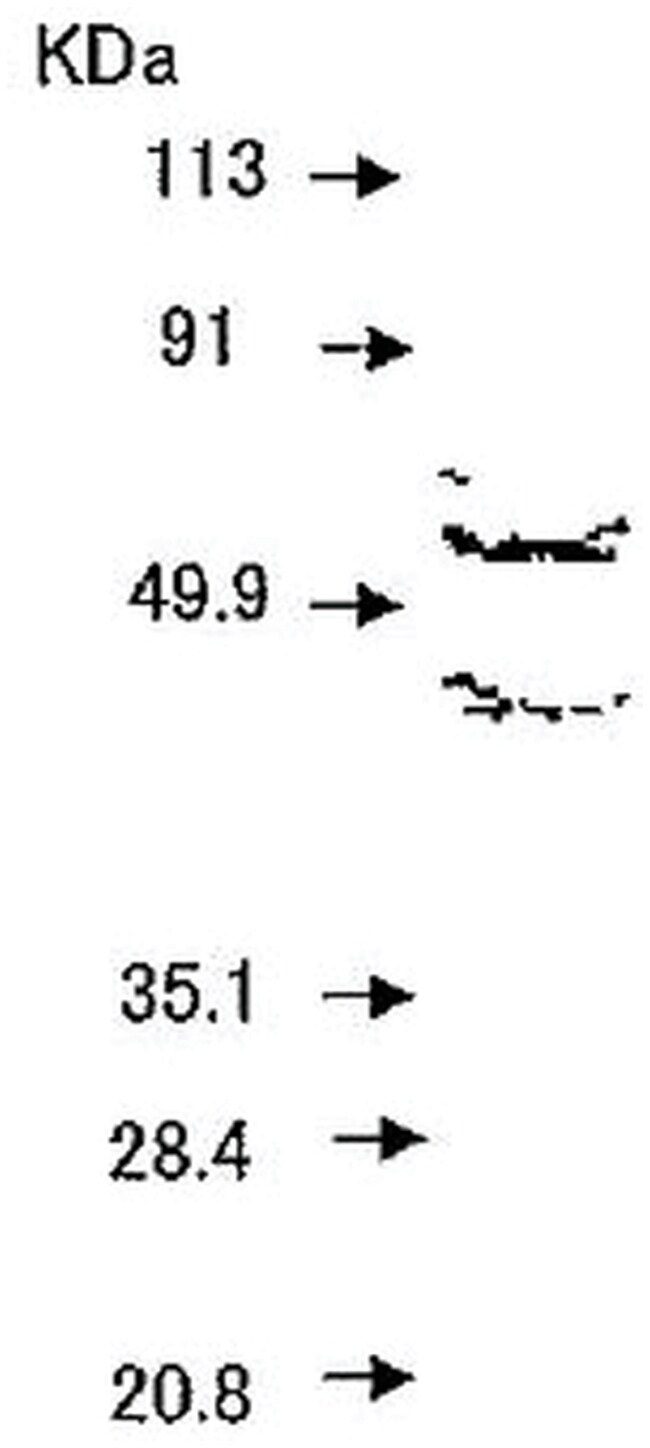 MilliporeSigmaMMP-1, Mouse, Unlabeled, Clone: 41-1E5, 100μg; Unlabeled:Antibodies | Fisher ...