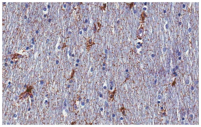 MilliporeSigma APC, CT, Mouse, Unlabeled, Clone: C-APC 28.9, 100μg; | Fisher Scientific