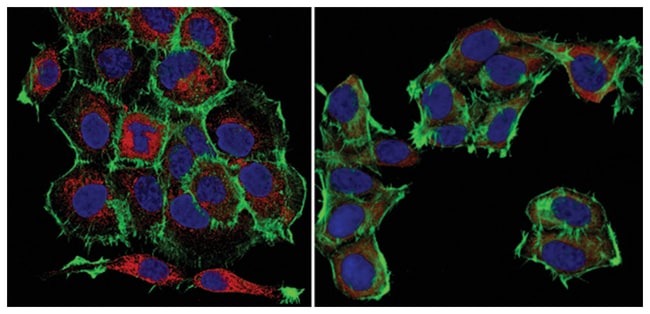 MilliporeSigma S100A4, Mouse, Unlabeled, Clone: 9D5.1, 100μg; Unlabeled:Antibodies | Fisher ...
