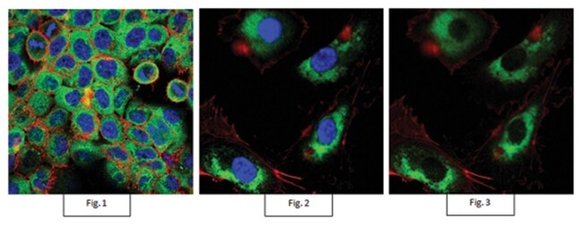 ANTI-PROHIBITIN-2/PHB2 CLONE