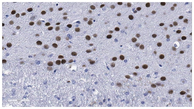 MilliporeSigma CTIP2/BCL11B, Rat, Unlabeled, Clone: 25B6, 100μg; Unlabeled:Antibodies | Fisher ...
