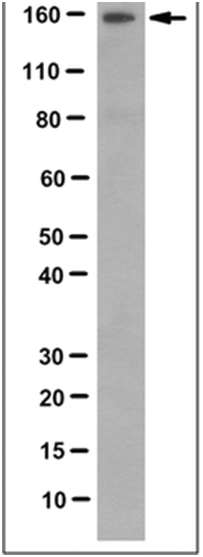 ANTI-SSH1, CLONE 12C6.1