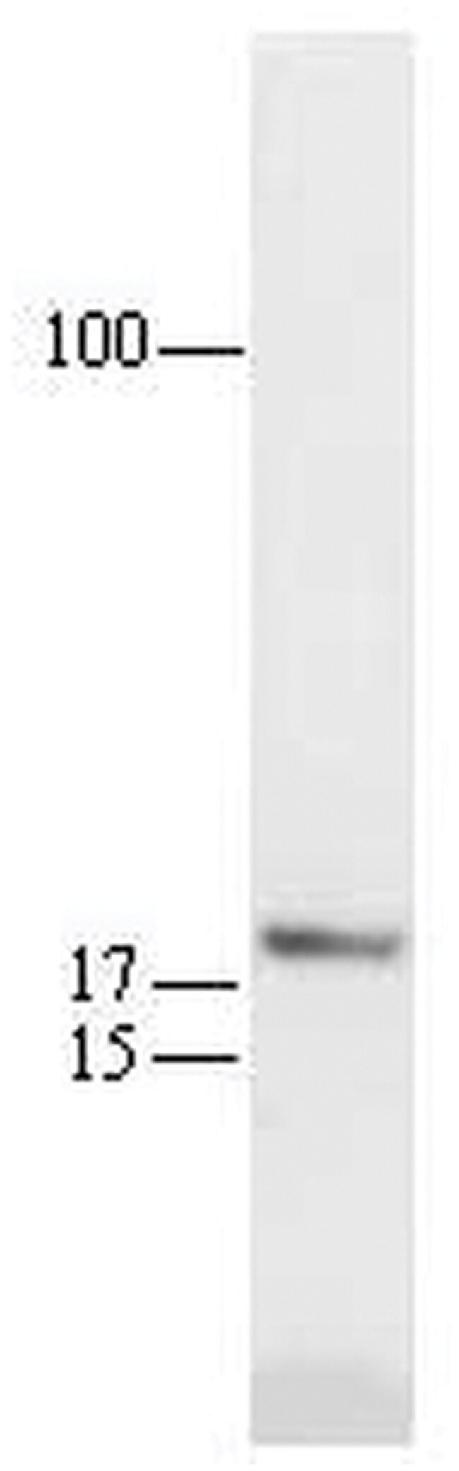 MilliporeSigma anti-p21WAF1 Clone: EA10, 100μg, Unlabeled:Antibodies, | Fisher Scientific