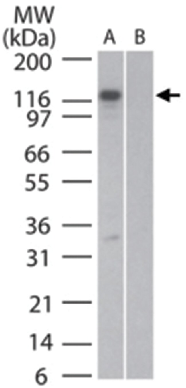 Dnmt3a, Mouse, Clone: 64B1446, Abnova 100μg; Unlabeled:Antibodies ...