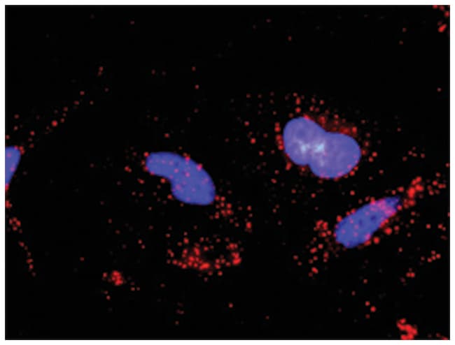 anti-MAP3K5, ERN1 Protein Protein Interaction Antibody Pair, Abnova 1 ...