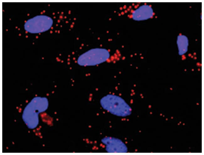 anti-WEE1 & FBXW11 Protein Protein Interaction Antibody Pair, Abnova™ 1 ...