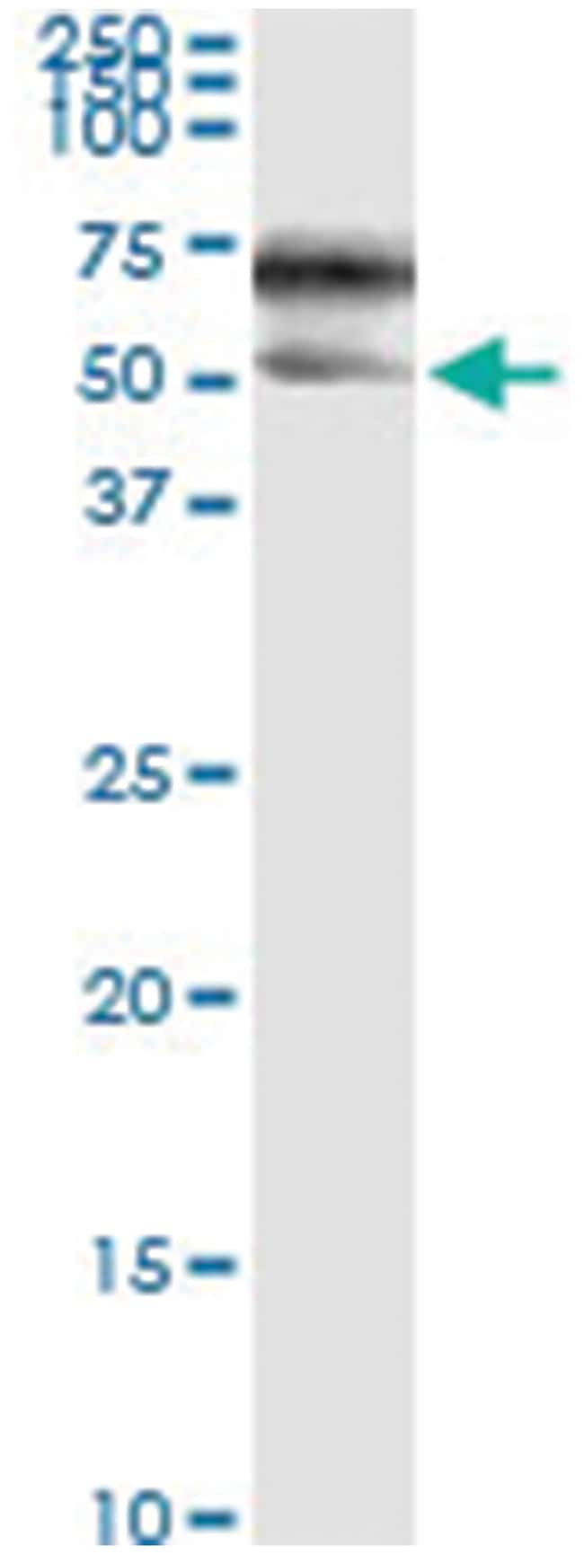 SERPINA3, Human, IP-WB Antibody Pair (PW2), Abnova 1 Set:Antibodies ...
