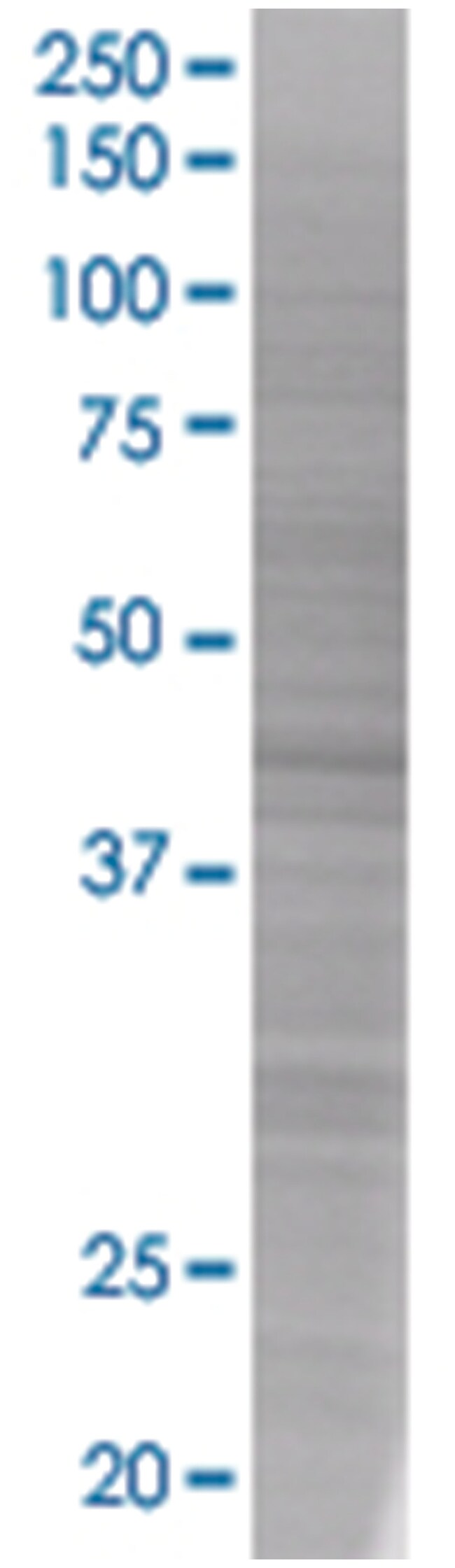 RCC1 293T Cell Overexpression Lysate (Denatured), Abnova 100μL:Protein ...