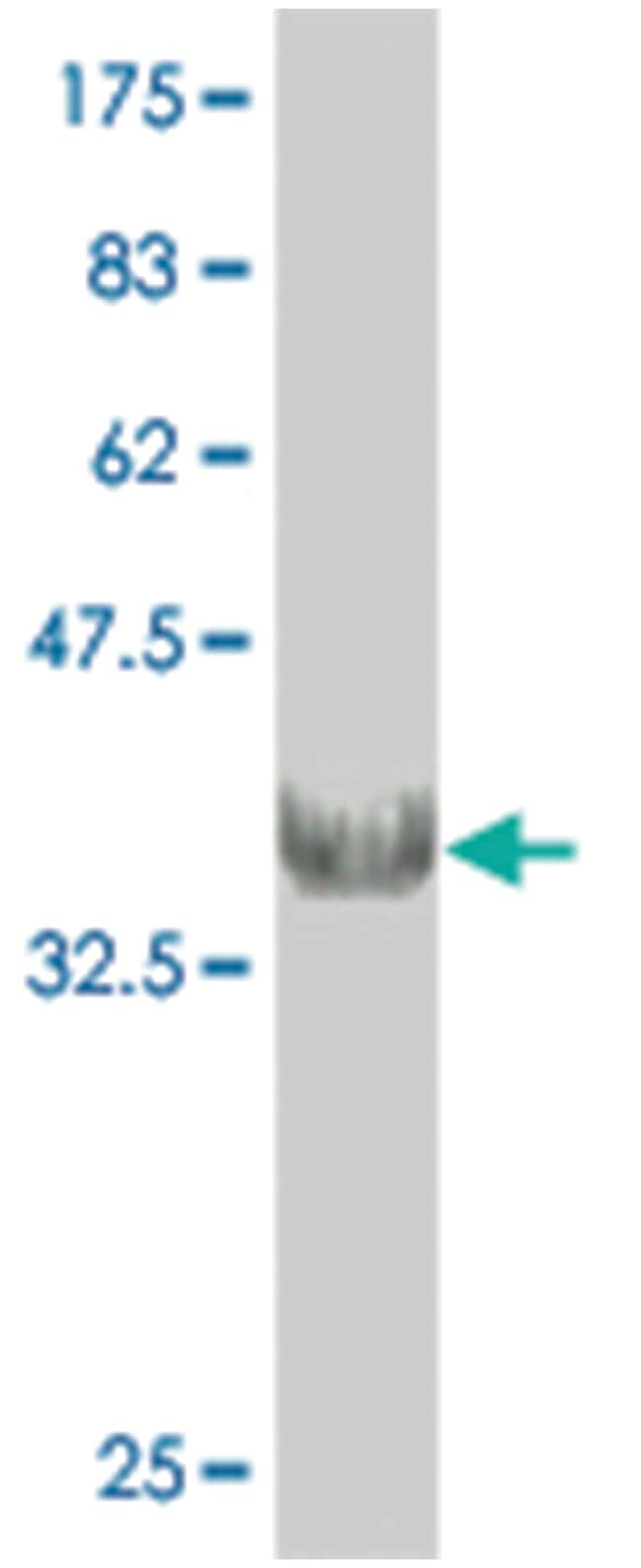 CHRNB1, Mouse, Clone: 4G4, Abnova™ 100μg; Unlabeled Primary Antibodies Cda to Ch | Fisher Scientific