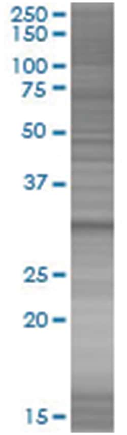 CNN2 293T Cell Overexpression Lysate (Denatured), Abnova 100μL | Fisher ...