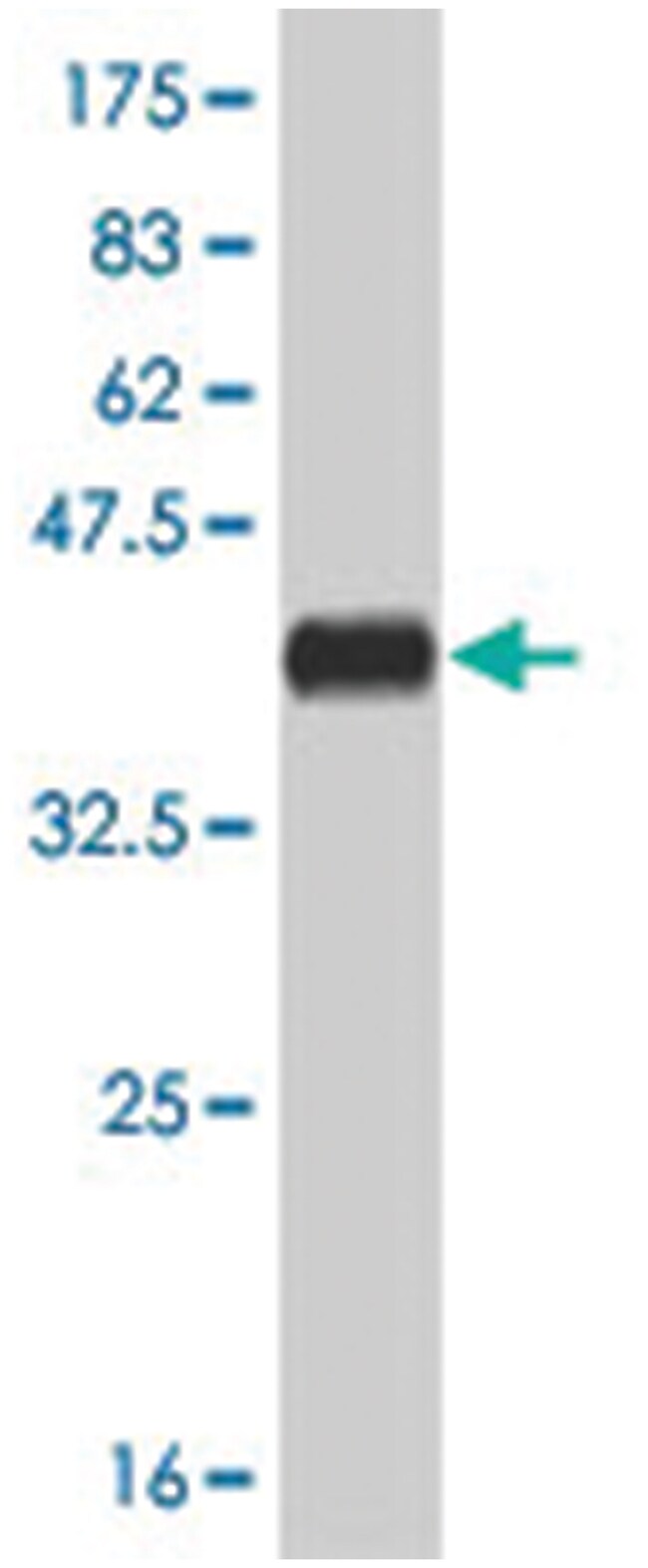 EGF (M01J), Mouse anti-Human, Clone: 2F1, Abnova 50μg; Unlabeled ...