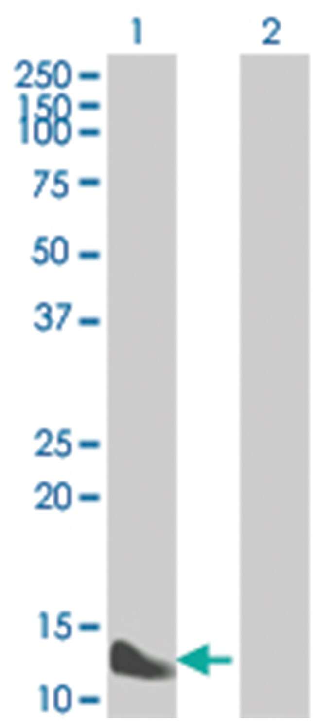 FABP1 293T Cell Overexpression Lysate (Denatured), Abnova 100μL:Protein ...