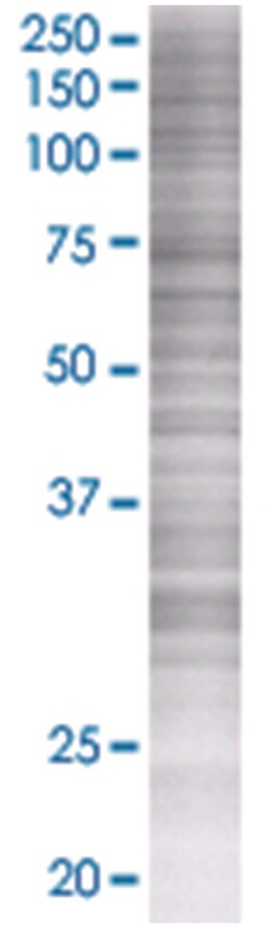 FOSB 293T Cell Overexpression Lysate (Denatured), Abnova 100μL:Protein ...