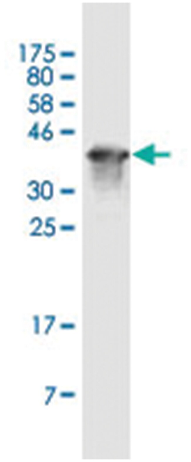 GABRE, Mouse, Clone: 1G11, Abnova 200μL; Unlabeled:Antibodies ...