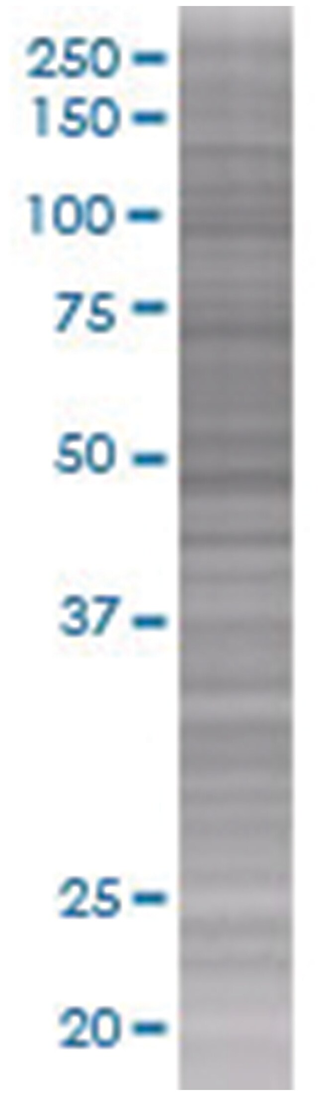 GLRB 293T Cell Overexpression Lysate (Denatured), Abnova 100μL:Protein ...