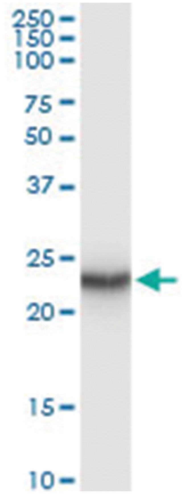 GUK1, Human, IP-WB Antibody Pair (PW1), Abnova™ 1 Set Matched Primary ...
