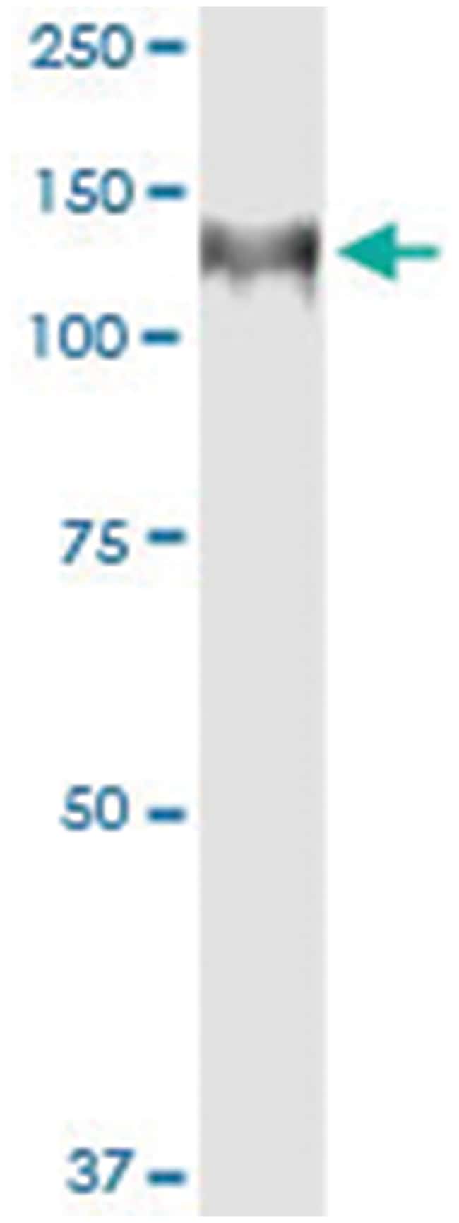 anti-HIP1, Human, IP-WB Antibody Pair, Abnova™ 1 Set Matched Primary ...