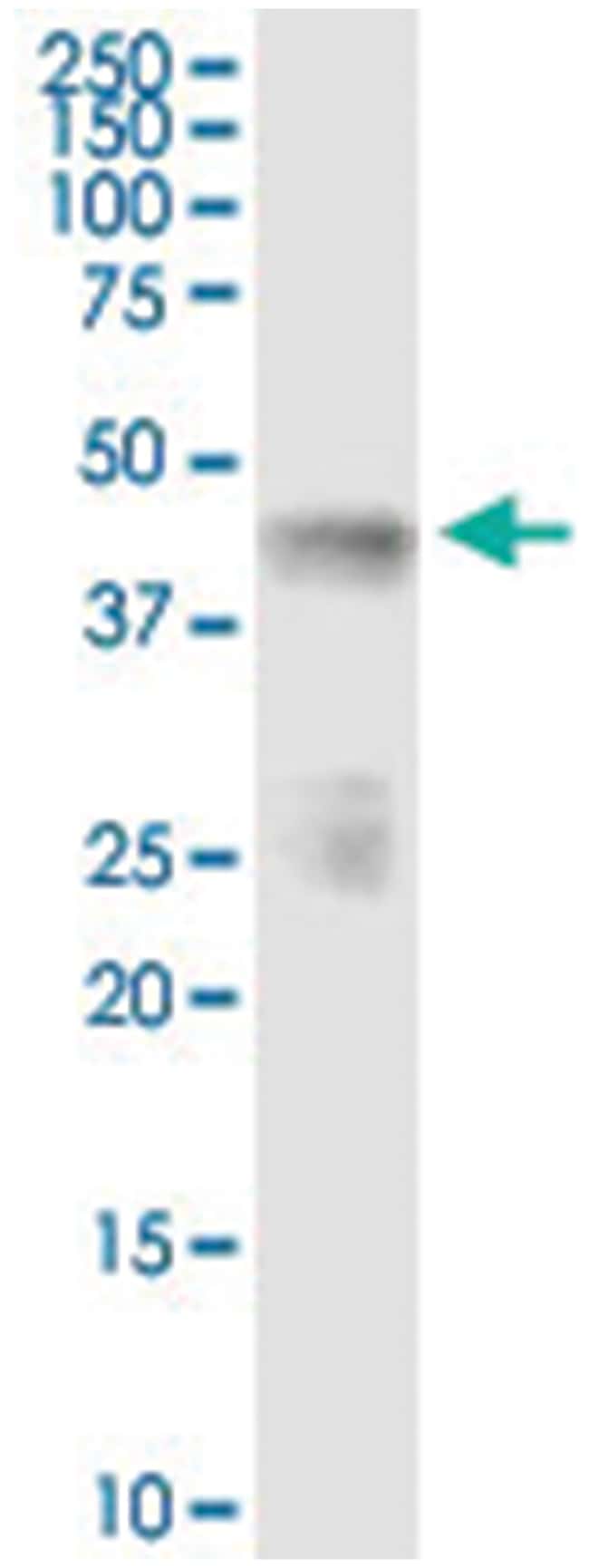 INPP1, Human, IP-WB Antibody Pair (PW3), Abnova™ 1 Set Matched Primary ...