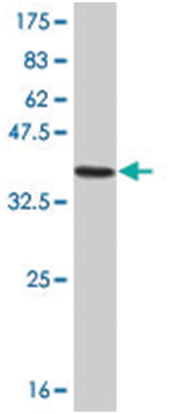 LIM homeobox 1, Mouse, Clone: 3G3, Abnova 100μg; Unlabeled:Antibodies ...
