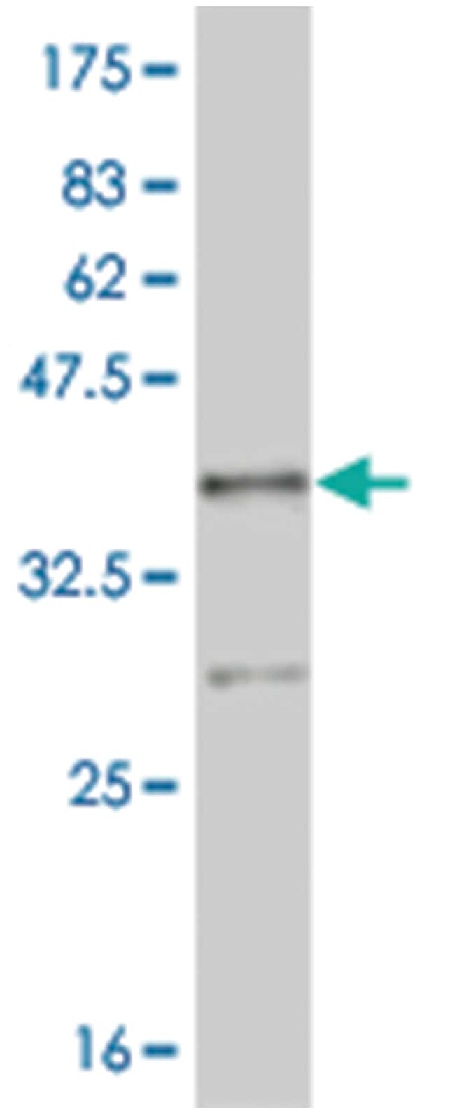 Abnova NR4A2, Mouse, Clone: 1D9, Abnova™ 100μg; Unlabeled Primary ...