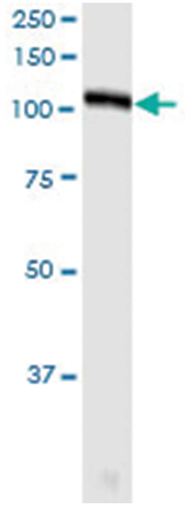 anti-TTK, Human, IP-WB Antibody Pair, Abnova 1 Set:Antibodies ...