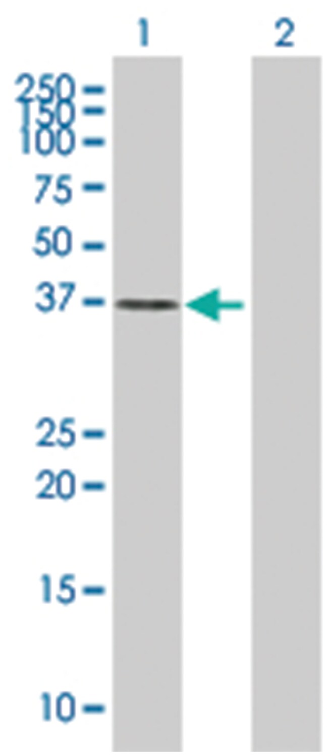 USF1 293T Cell Overexpression Lysate (Denatured), Abnova 100μL:Protein ...