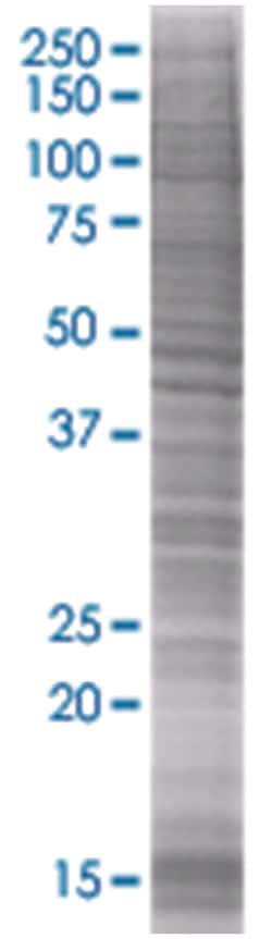 ZNF133 293T Cell Overexpression Lysate (Denatured), Abnova 100μL ...