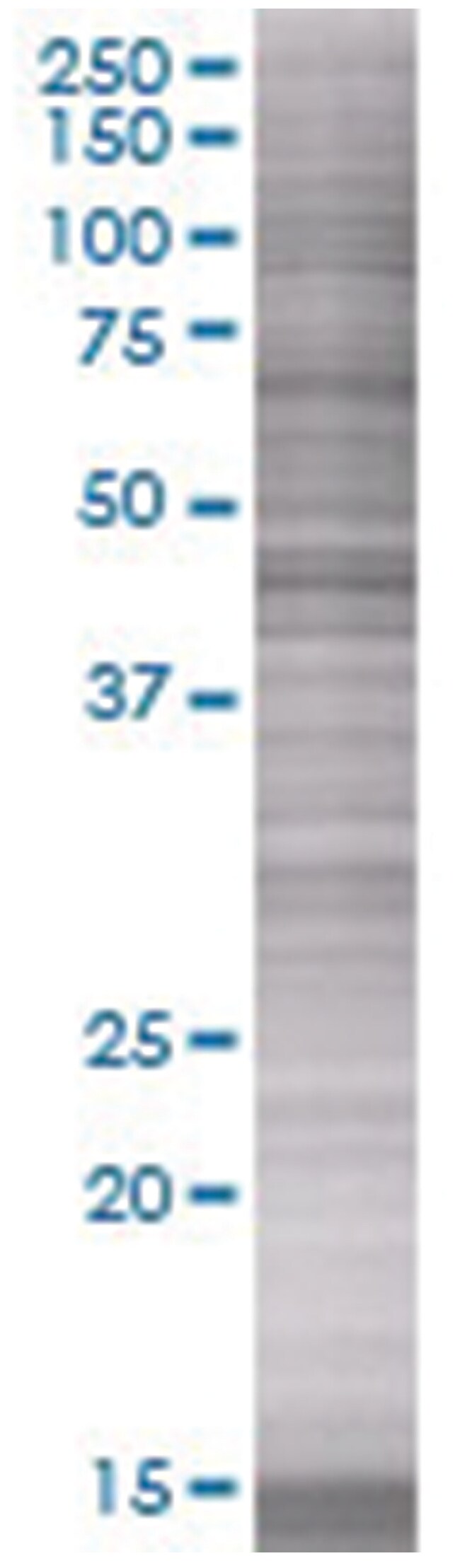 NCK2 293T Cell Overexpression Lysate (Denatured), Abnova 100μL:Protein ...
