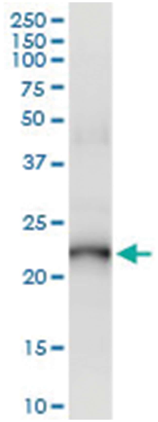 anti-PDE4DIP, Human, IP-WB Antibody Pair, Abnova™ 1 Set Matched Primary ...