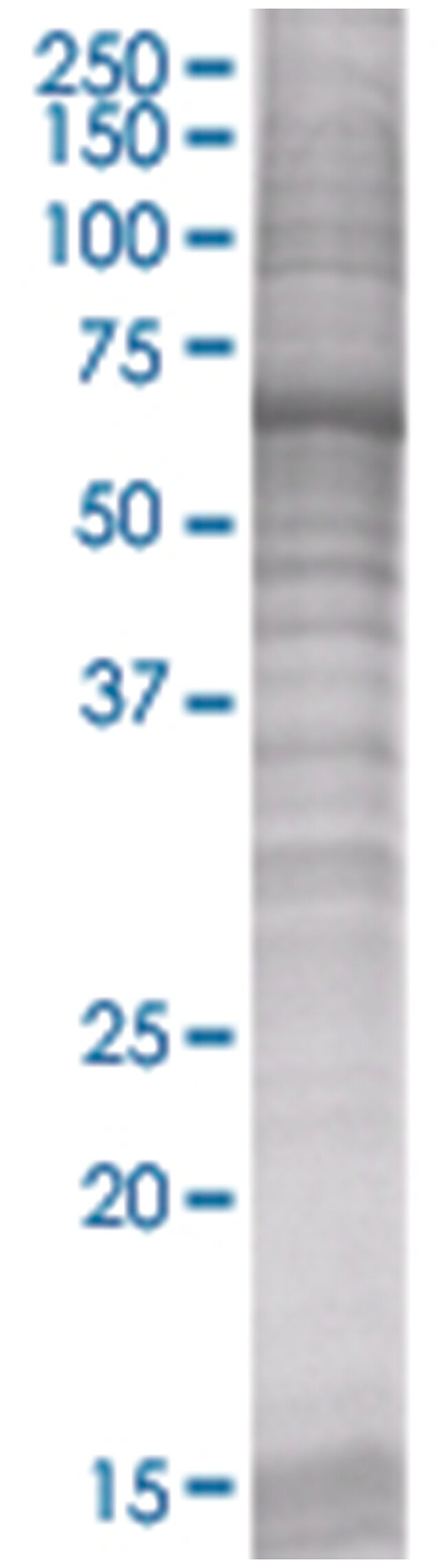 SCAMP2 293T Cell Overexpression Lysate (Denatured), Abnova 100μL ...