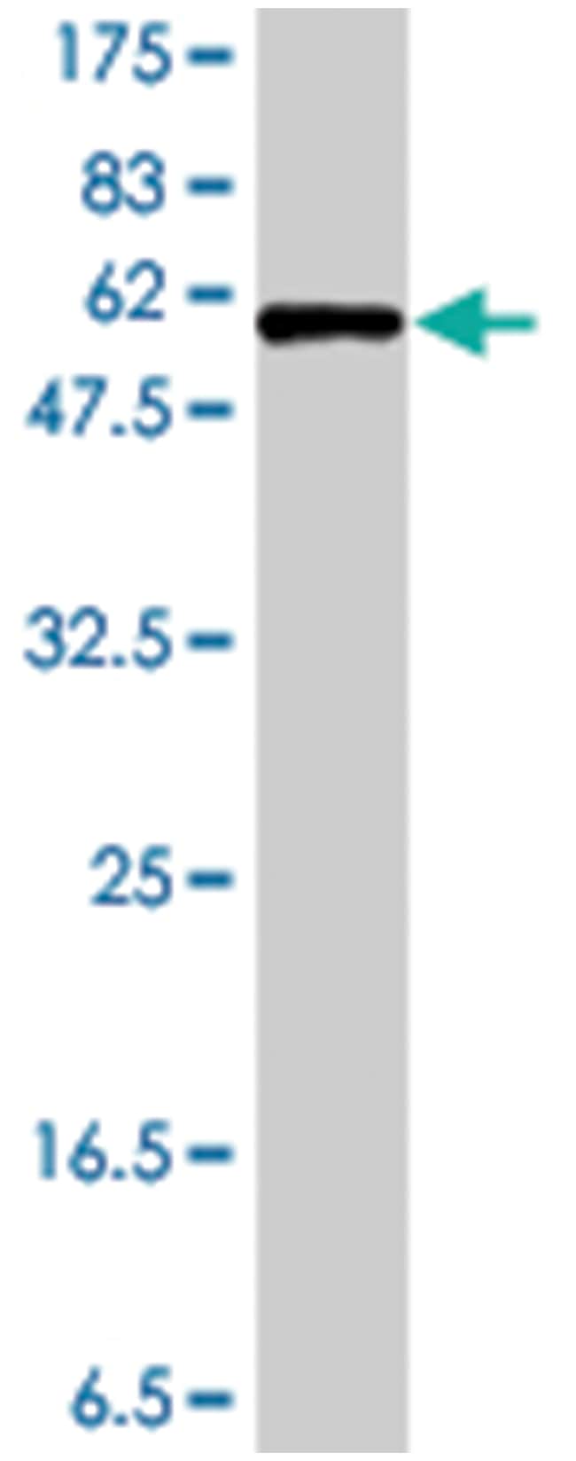 DHRS9, Mouse, Polyclonal Antibody, Abnova 50µL; Unlabeled:Life Sciences ...