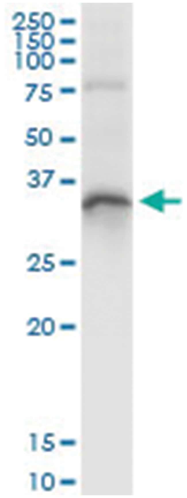 DHRS9, Human, IP-WB Antibody Pair (PW3), Abnova 1 Set:Antibodies ...
